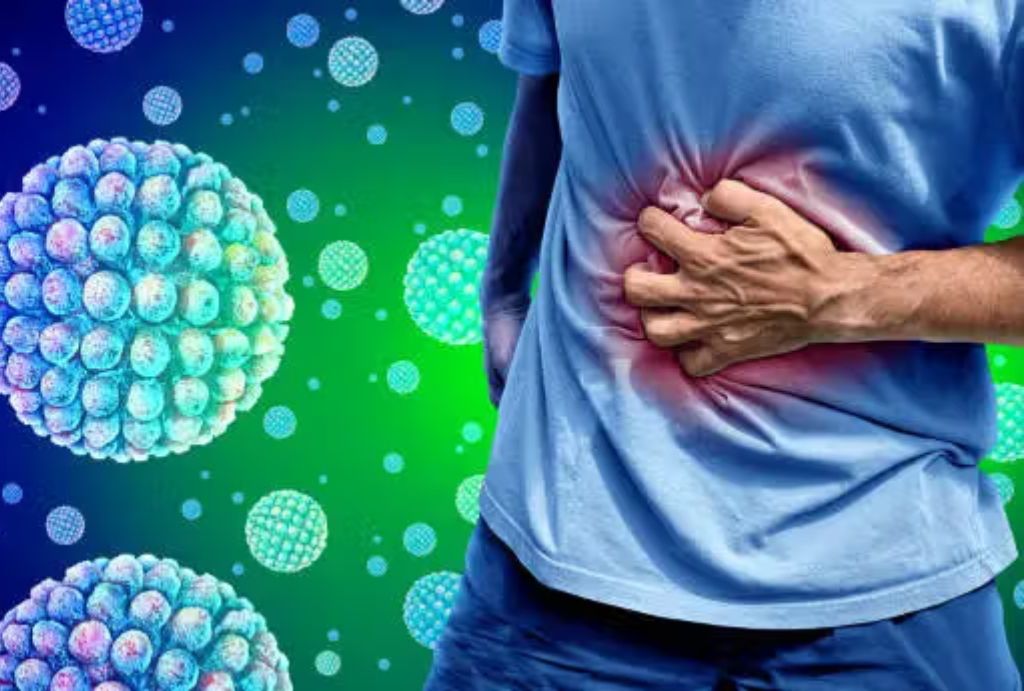 Urgent Alert: Norovirus-Stomach Flu Cases Surge in Washington – Wood County Now